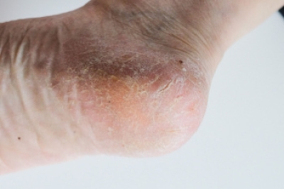 Nashville Family Foot Care PLLC - Podiatrist, Foot Doctor Nashville, TN